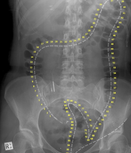 Medical - Arkwright Technologies